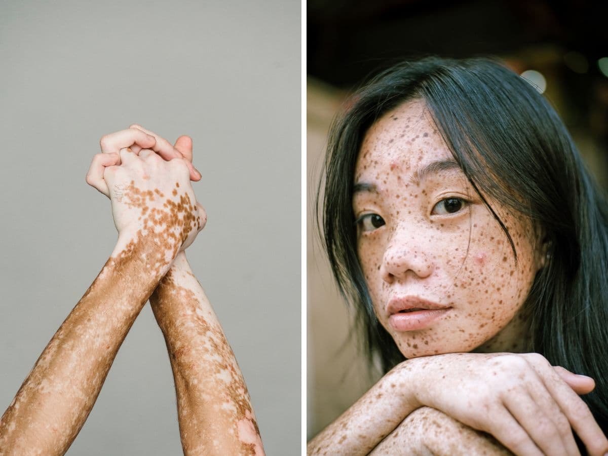 Sensitive Skin: What's The Best Skincare Option For You?